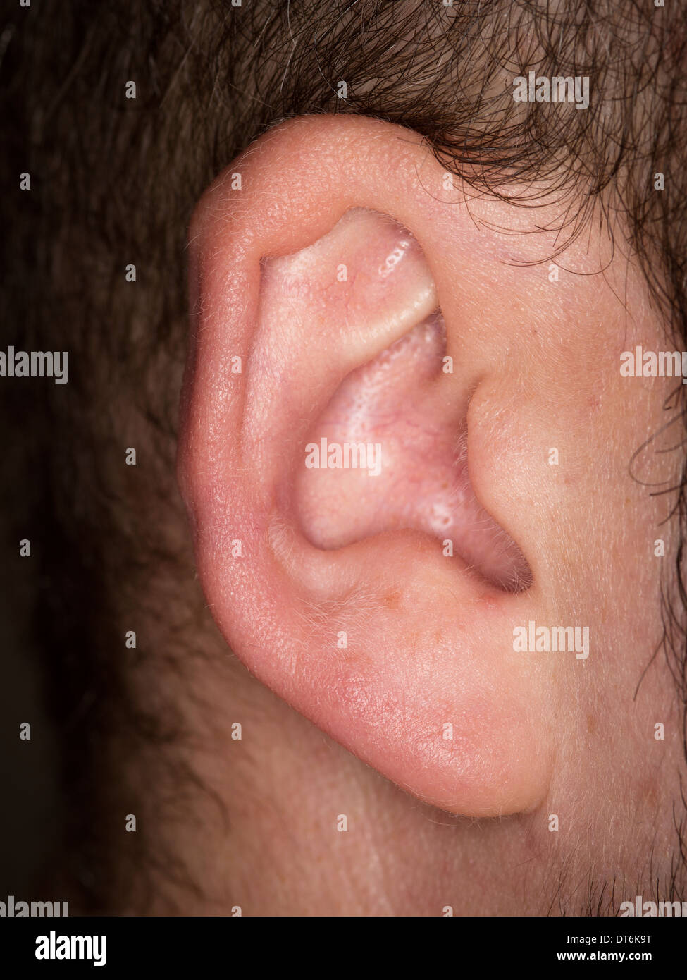 Human ear darwins point hi-res stock photography and images - Alamy