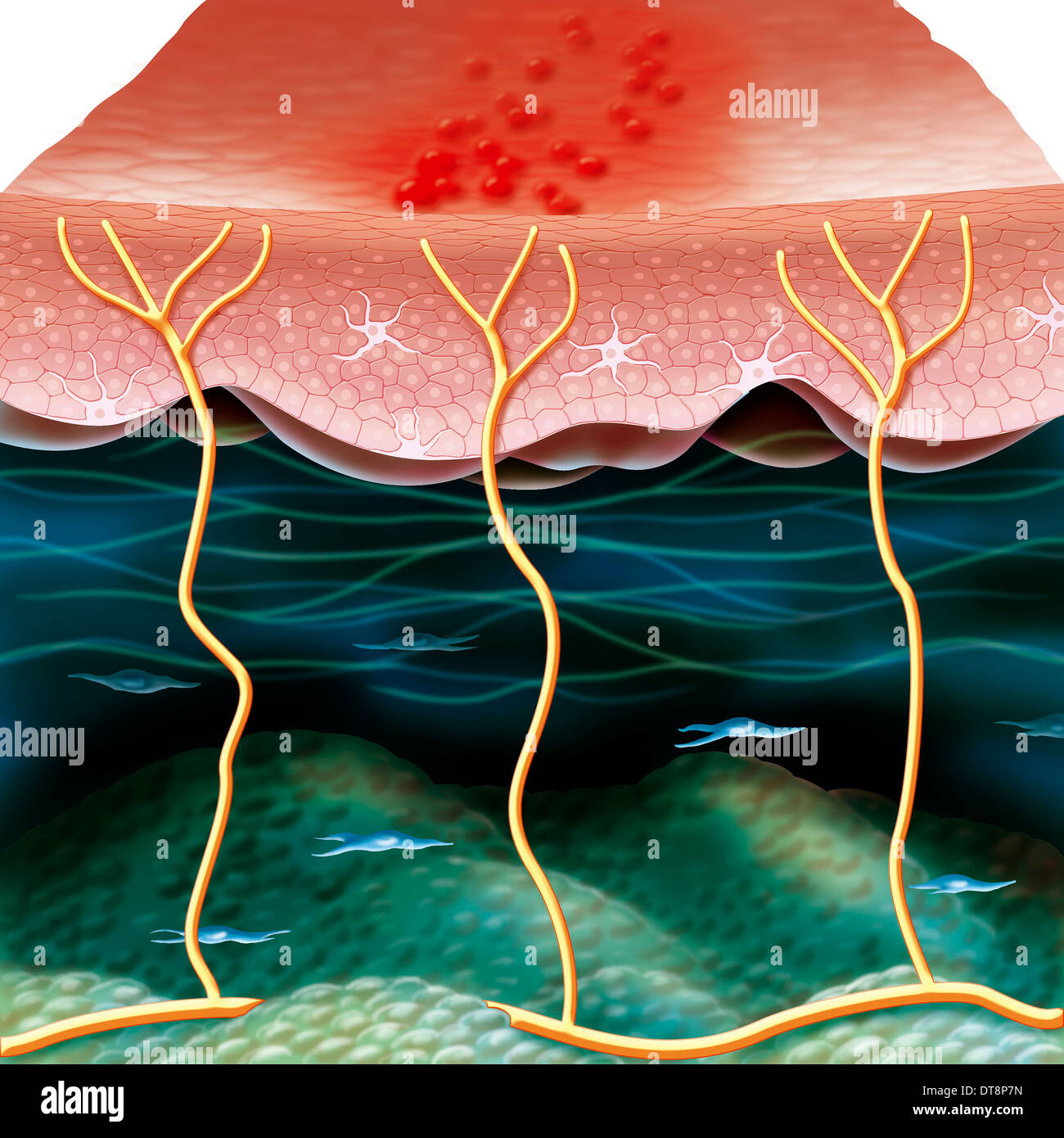 Shingles hi-res stock photography and images - Alamy