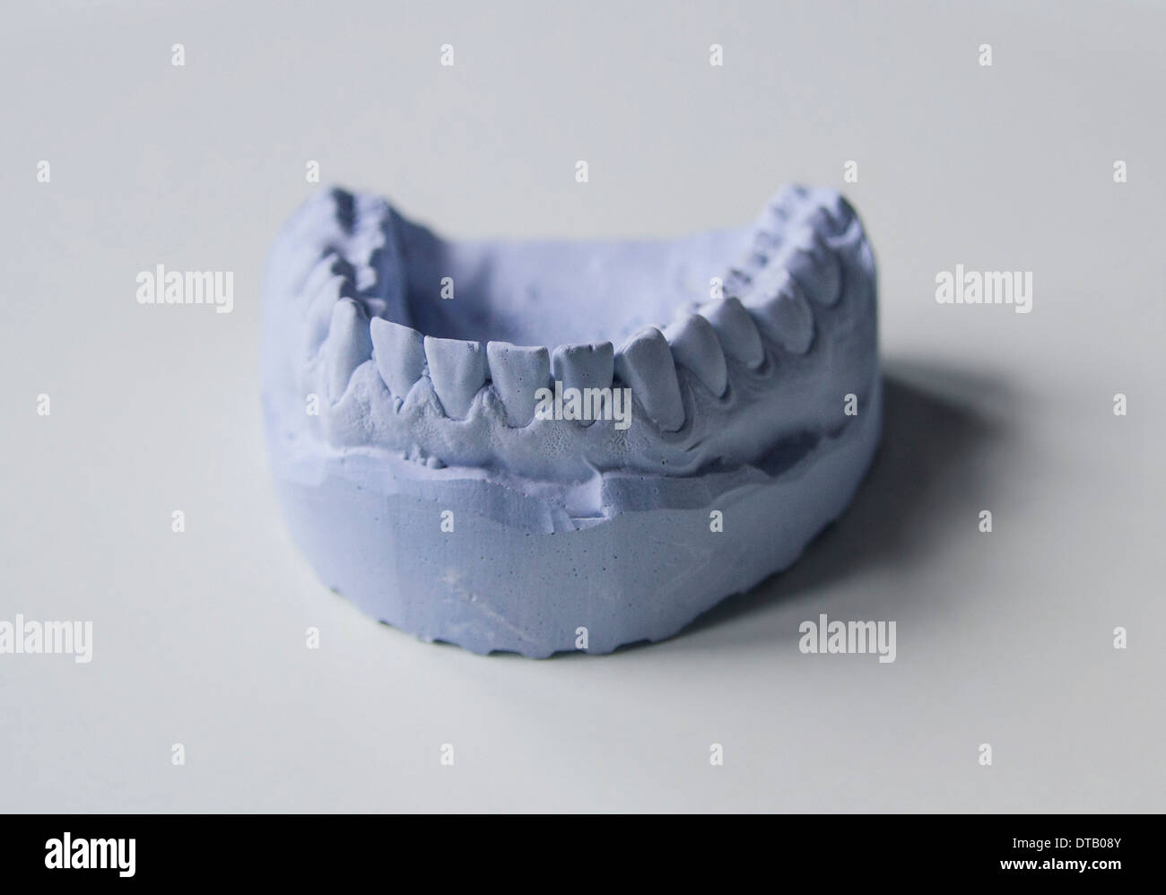 Teeth mould hi-res stock photography and images - Alamy
