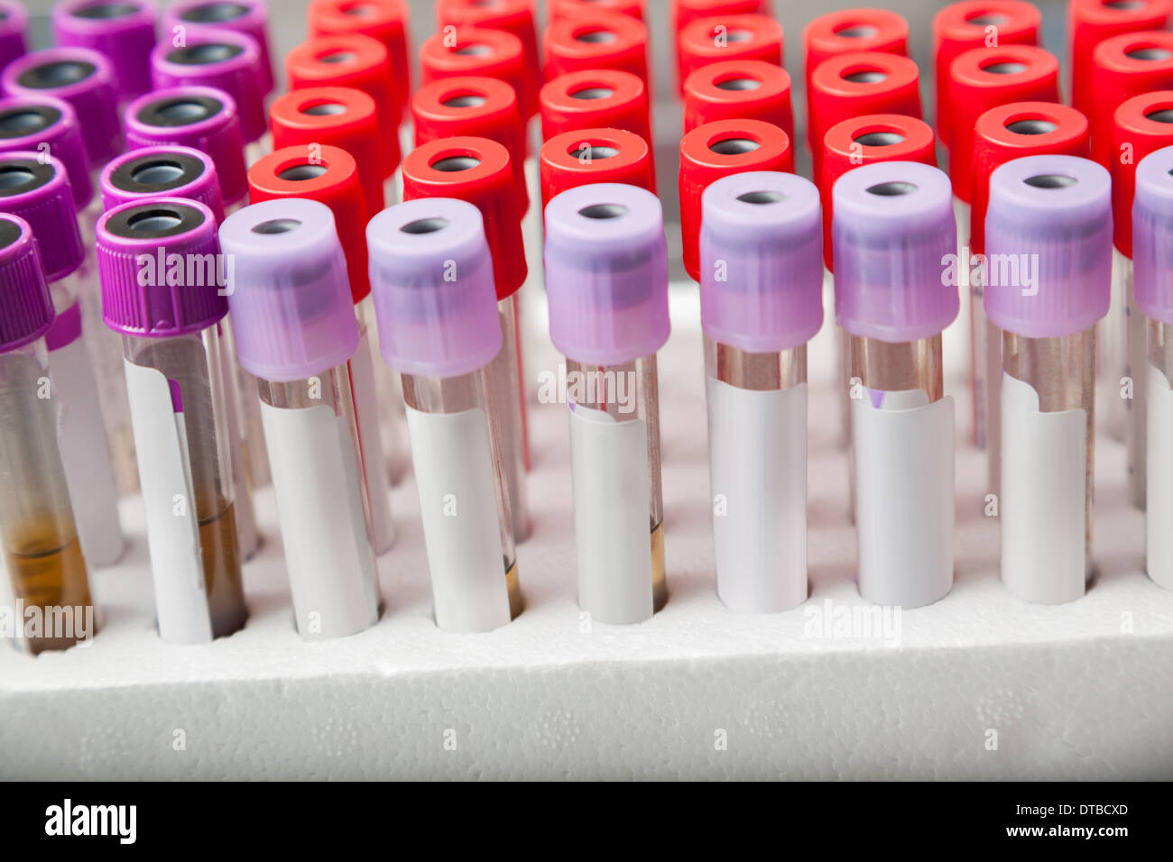 Rack Of Test Tubes Stock Photo - Alamy