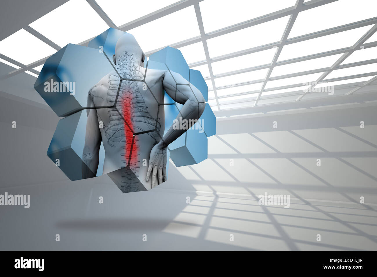 Composite image of back injury diagram on abstract screen Stock Photo ...