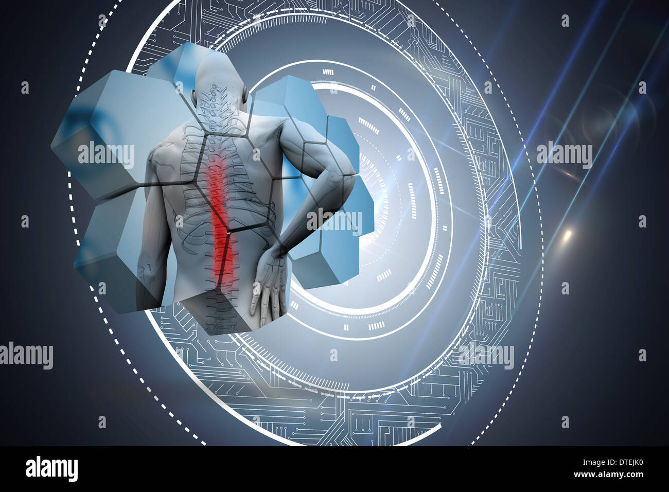 Composite image of back injury diagram on abstract screen Stock Photo ...