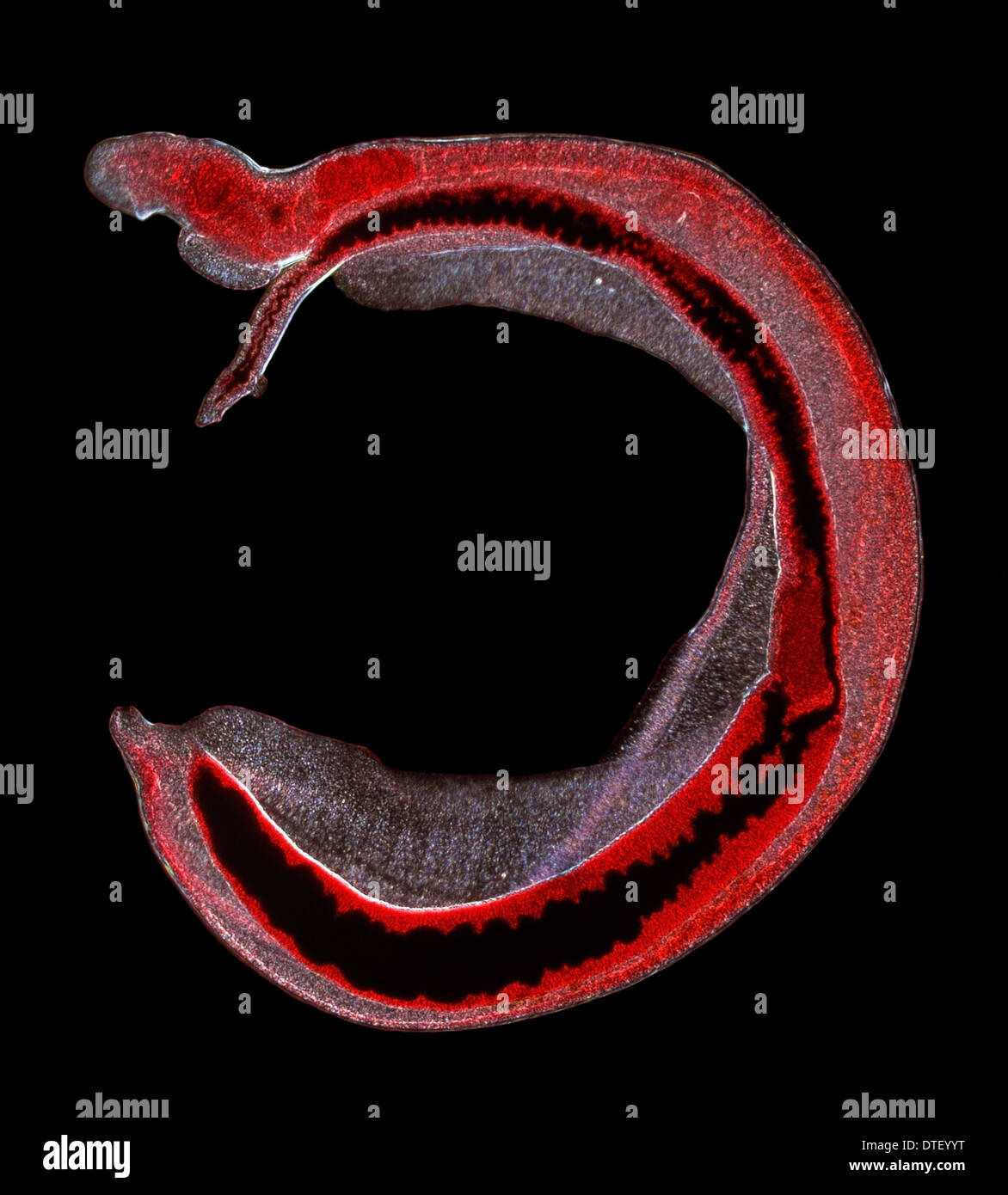 Schistosoma spp., blood fluke Stock Photo - Alamy
