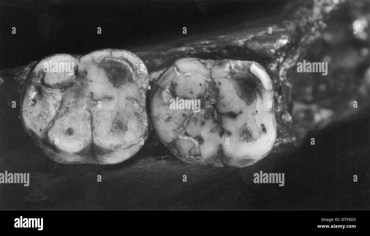 Human teeth molars anatomy Black and White Stock Photos & Images - Alamy