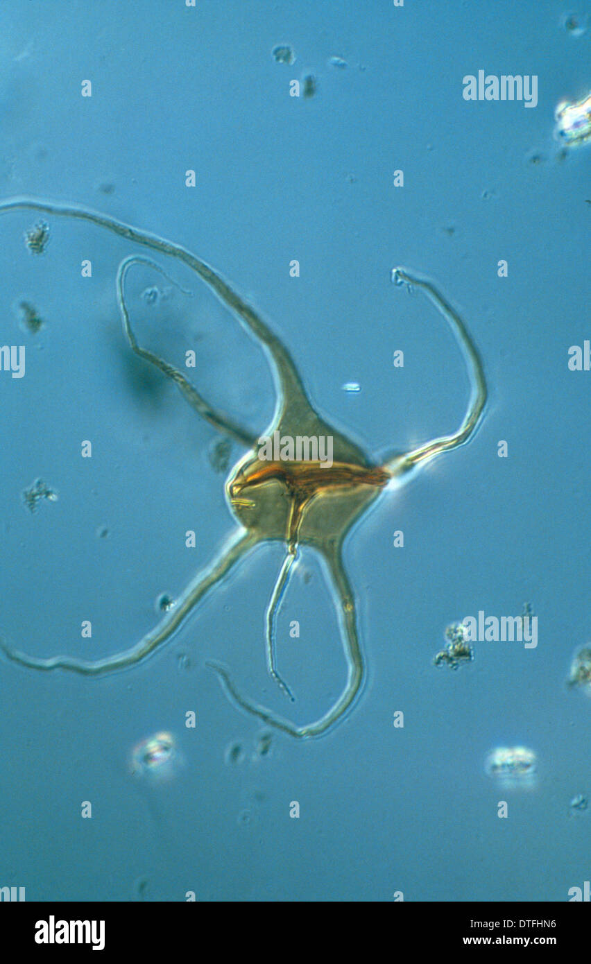 Photomicrograph: Acanthomorph acritarch, microfossil Stock Photo - Alamy