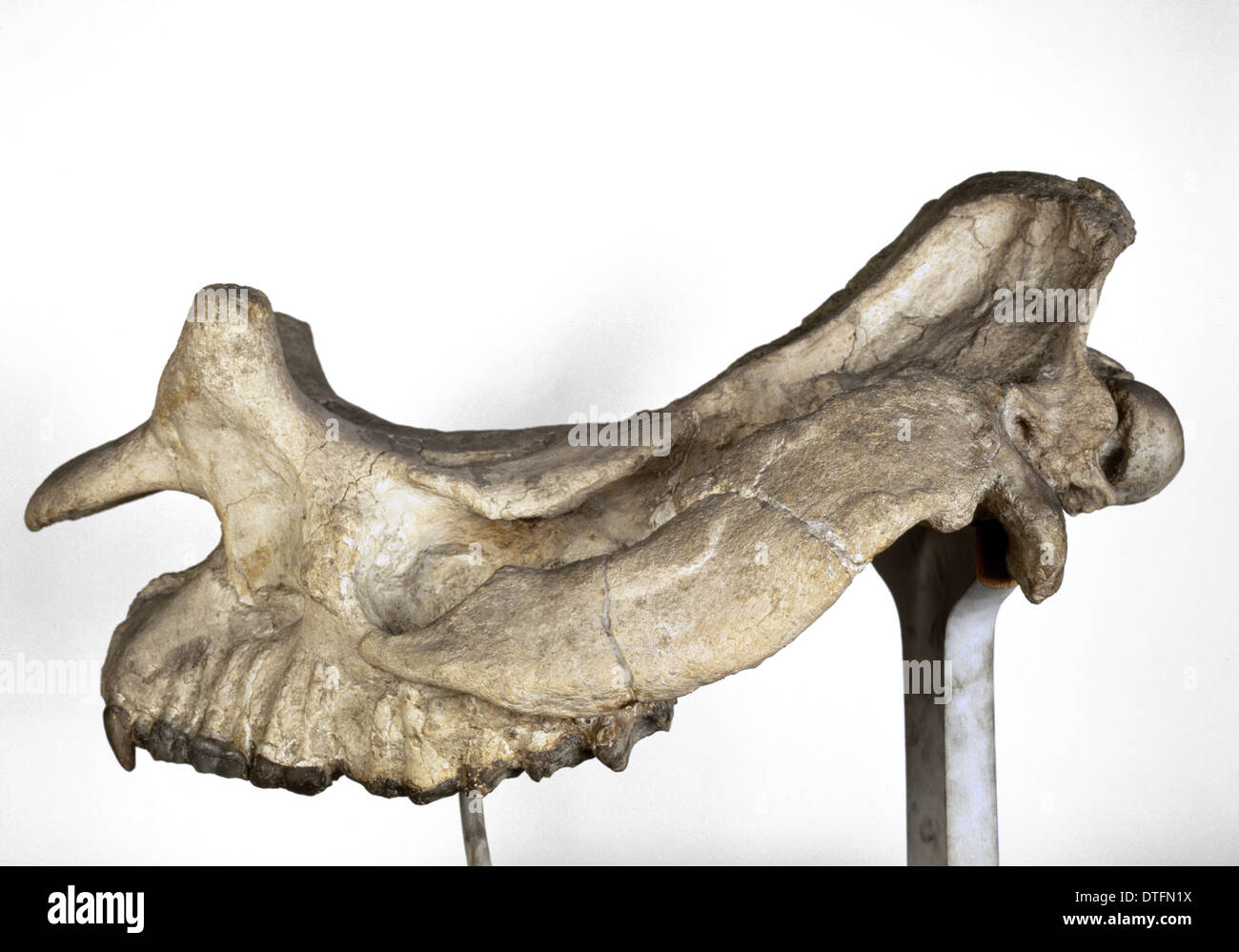 Placental anatomy hi-res stock photography and images - Alamy