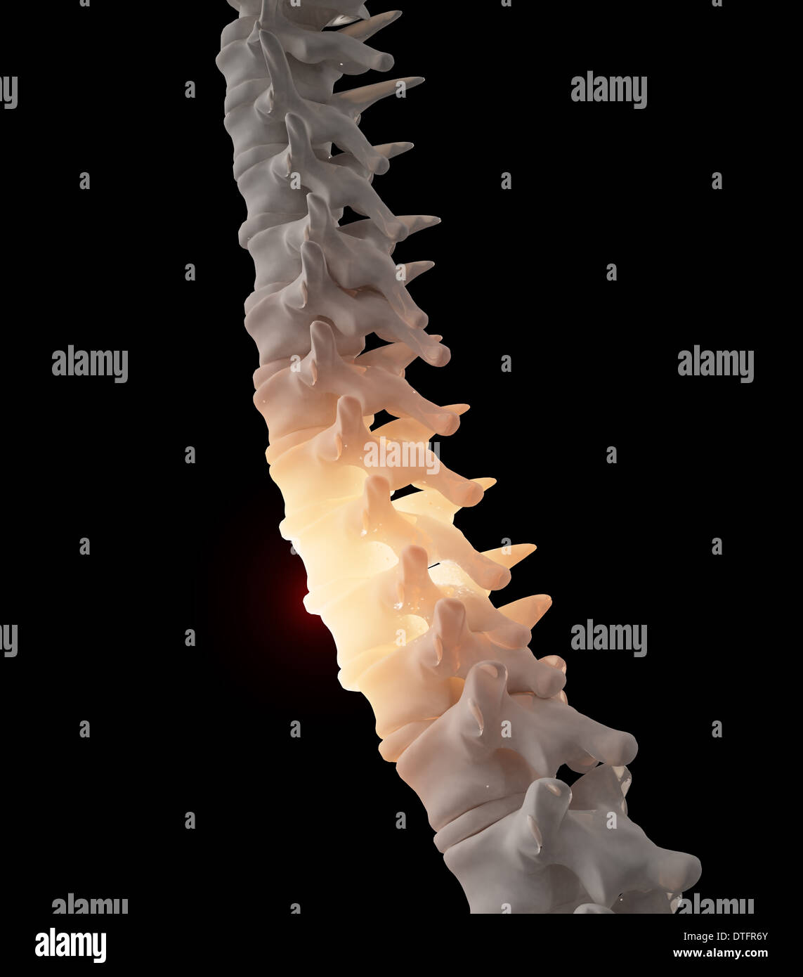 Anatomy and medical illustration - spine pain Stock Photo - Alamy