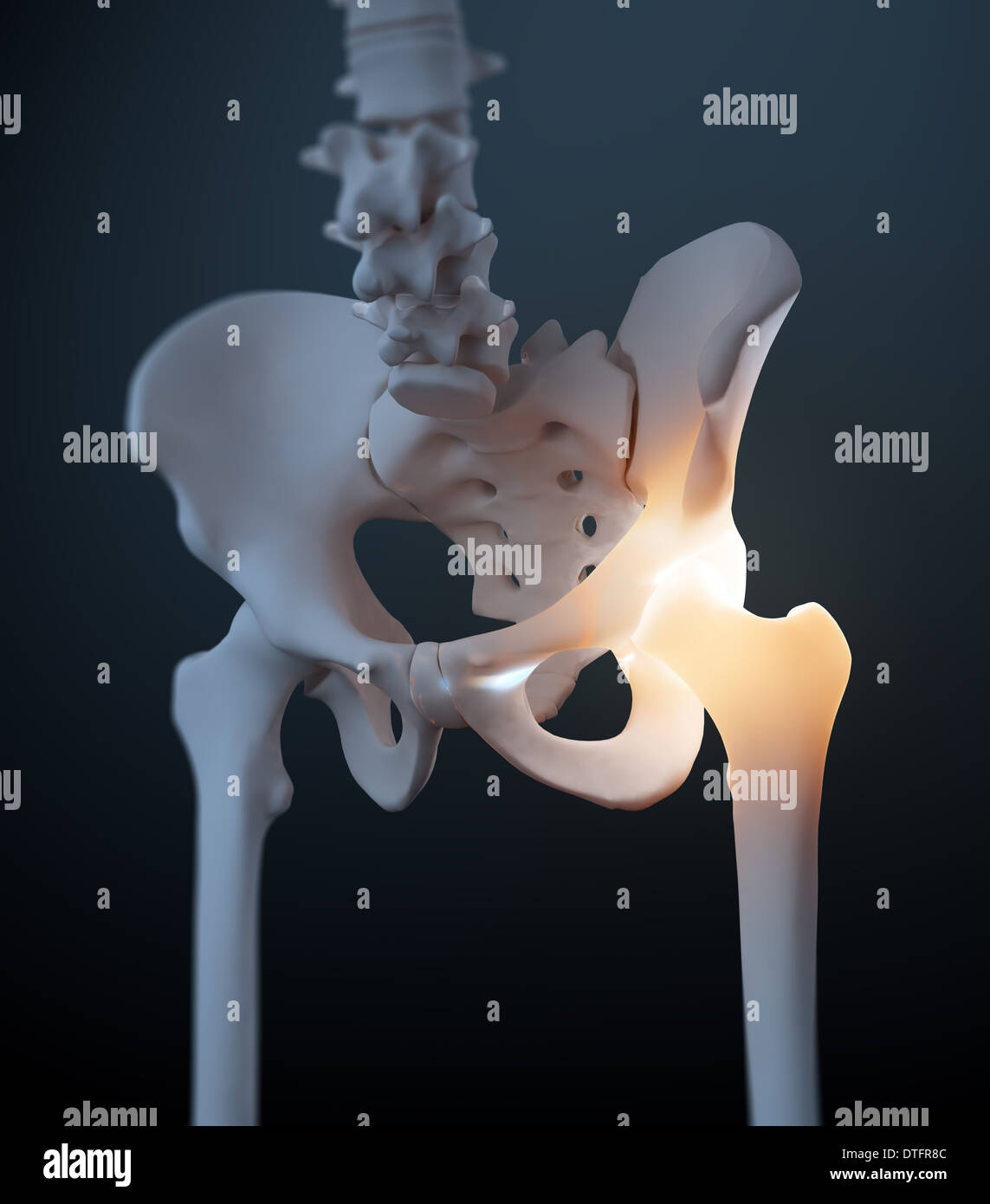 Anatomy illustration - hip and pelvis pain Stock Photo - Alamy