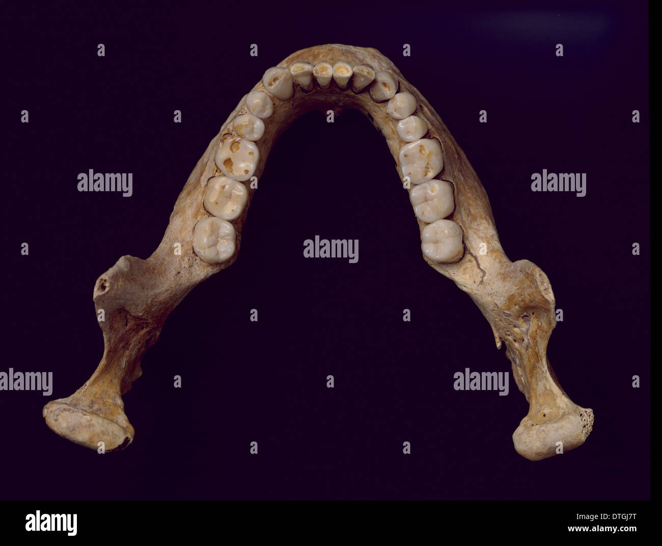 Human Mandible High Resolution Stock Photography and Images - Alamy
