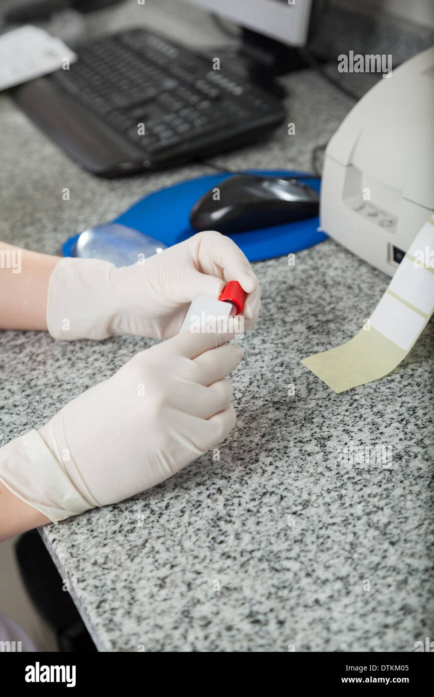 Specimen labeling hi-res stock photography and images - Alamy