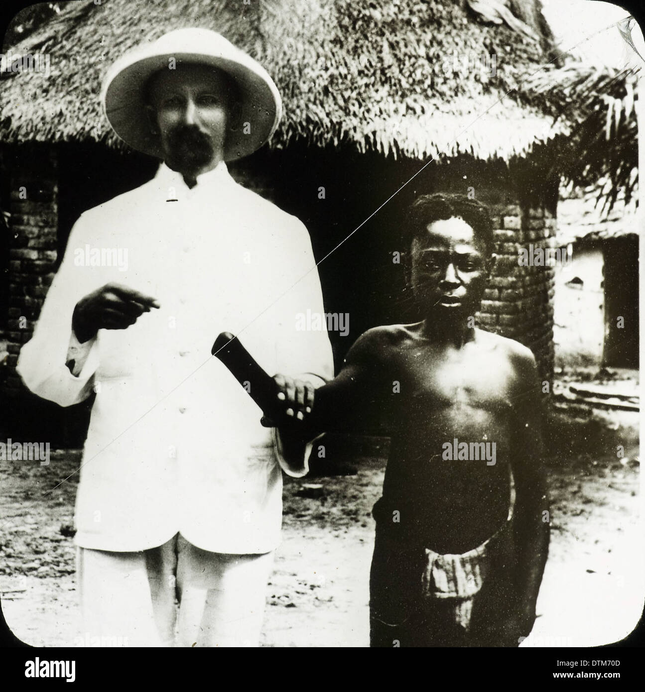 A historical photograph showing a victim of atrocities in the Congo ...