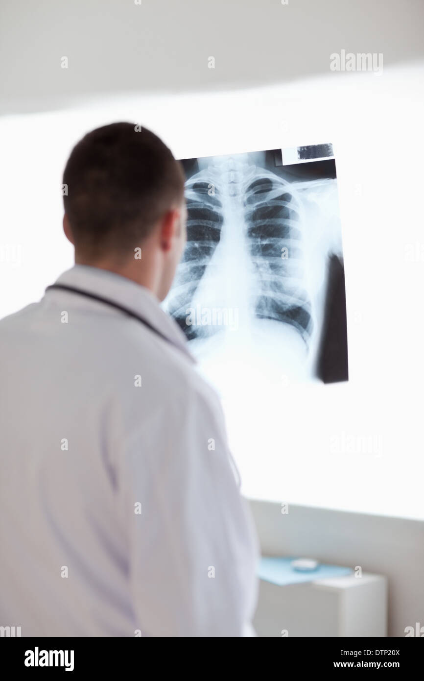 Doctor using light to check x-ray Stock Photo - Alamy