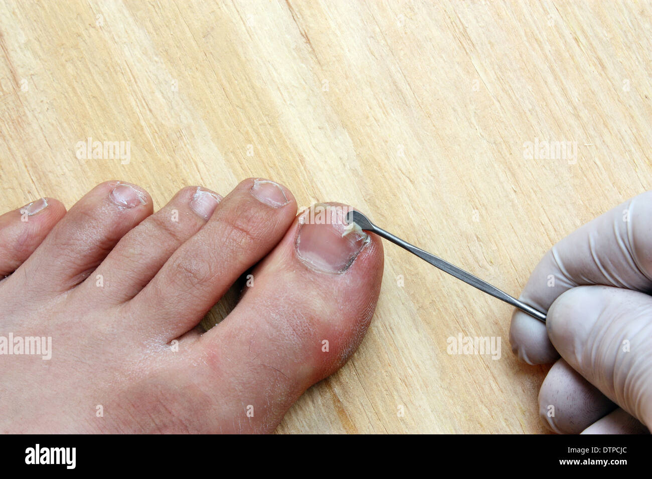 Smelly feet bacteria hi-res stock photography and images - Alamy