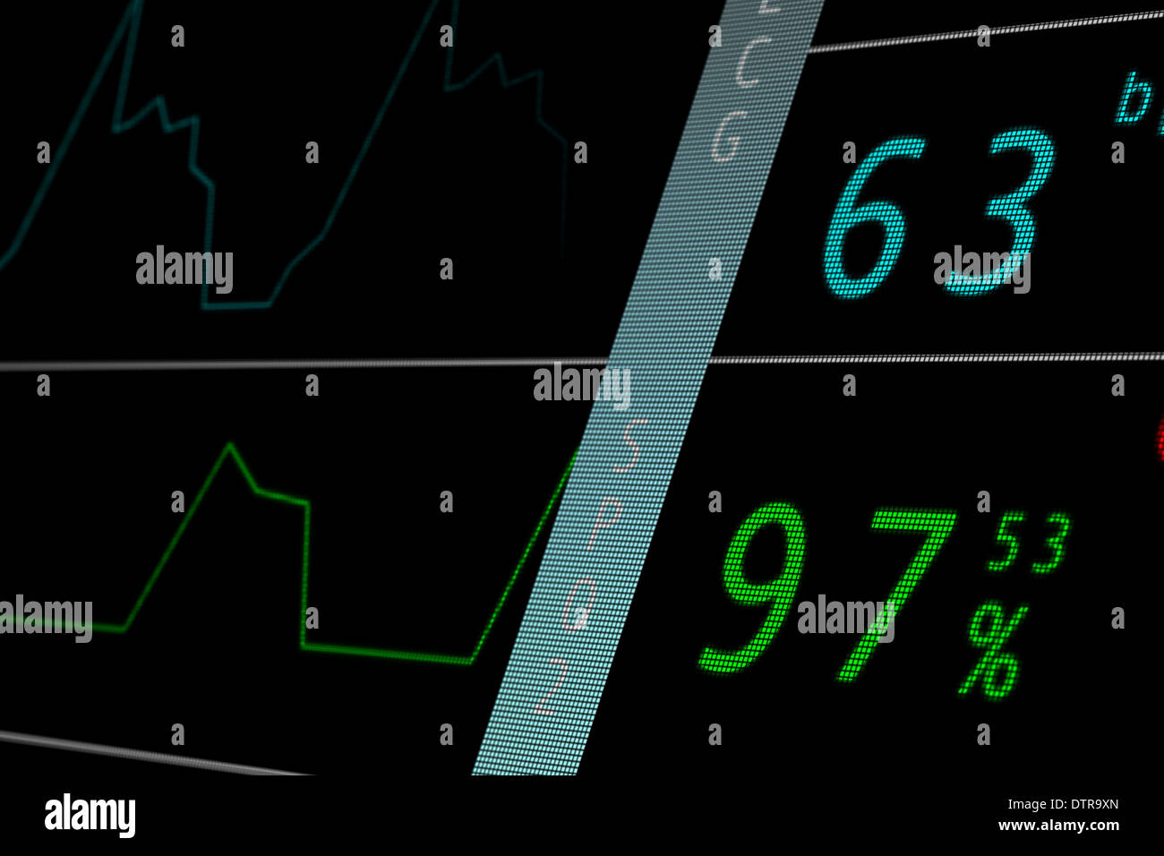 Heart Monitor ECG EKG Illustration Stock Photo - Alamy