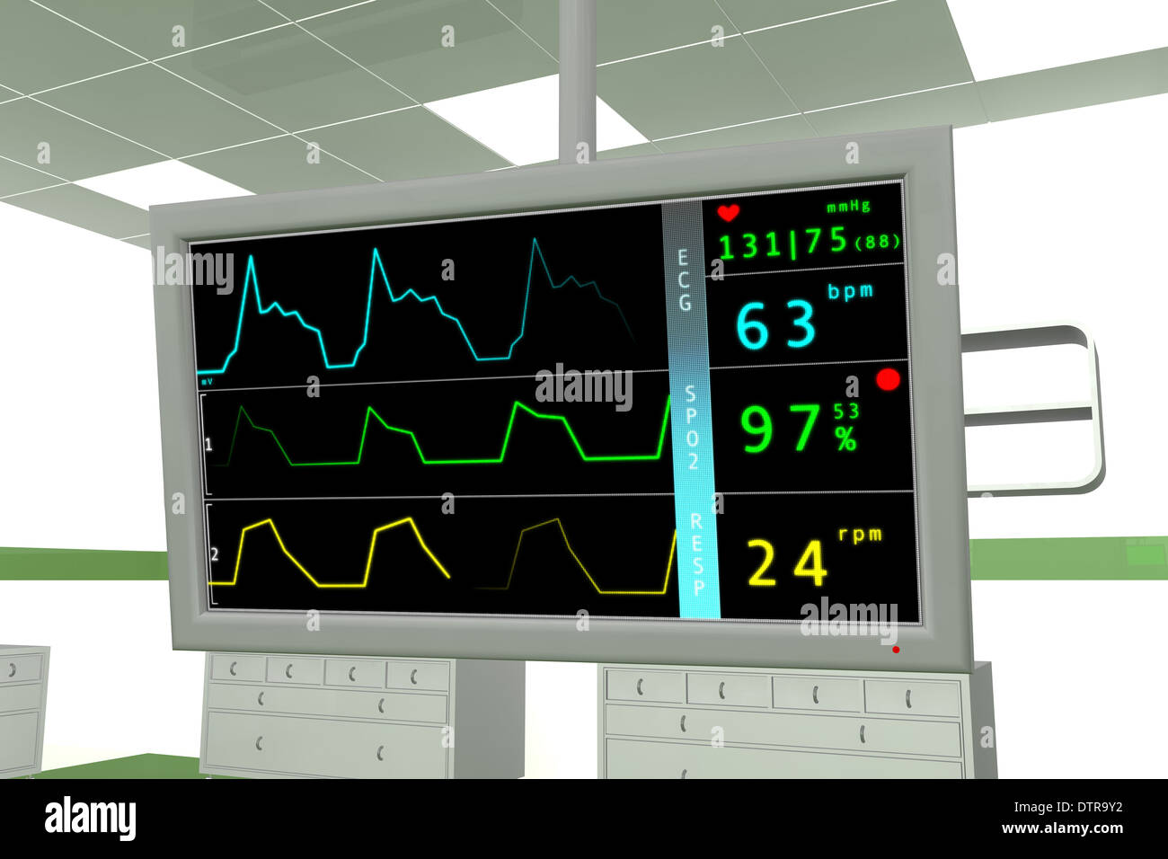 Heart Monitor ECG EKG Illustration Stock Photo - Alamy
