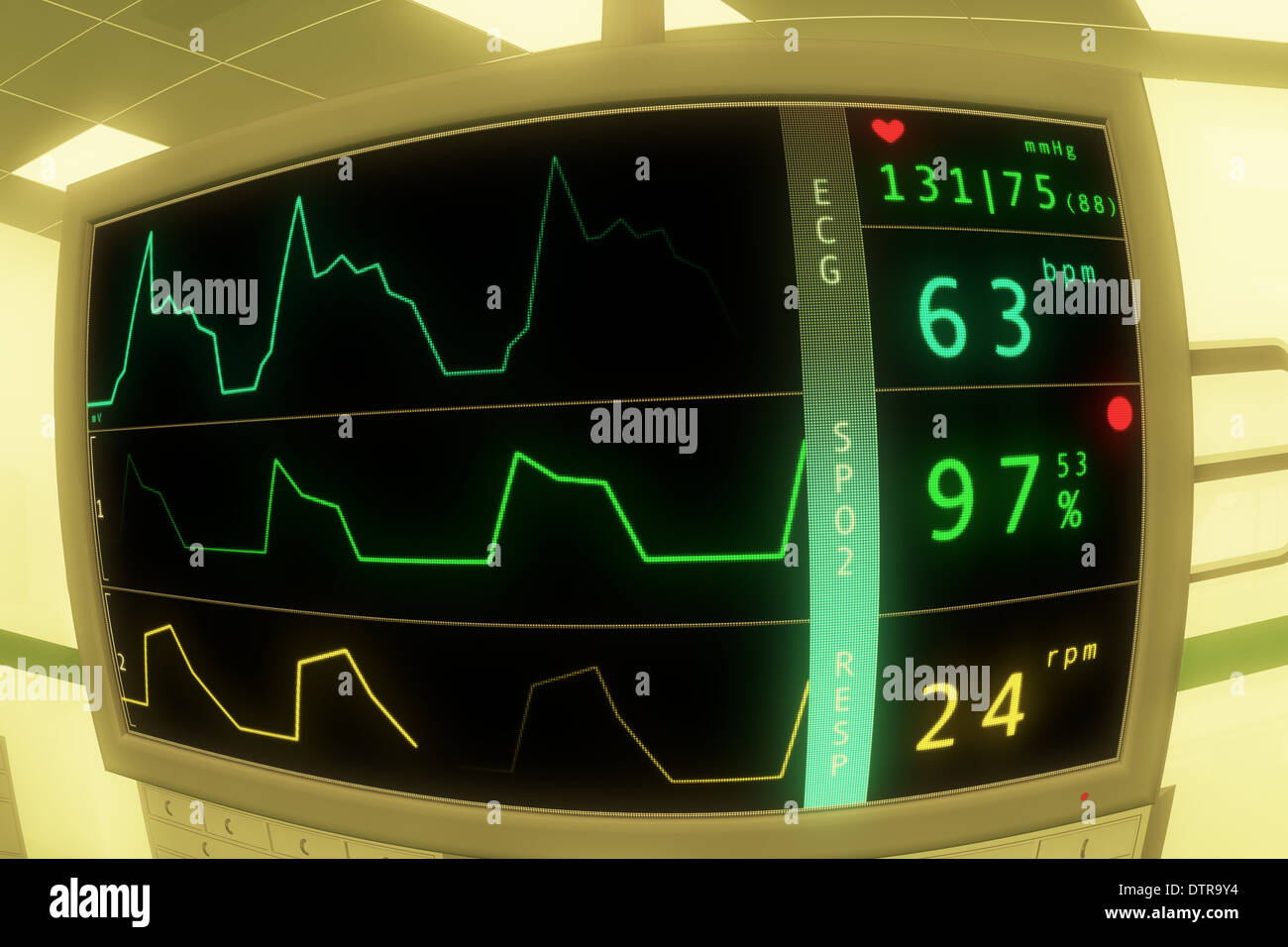 Heart Monitor ECG EKG Illustration Stock Photo - Alamy