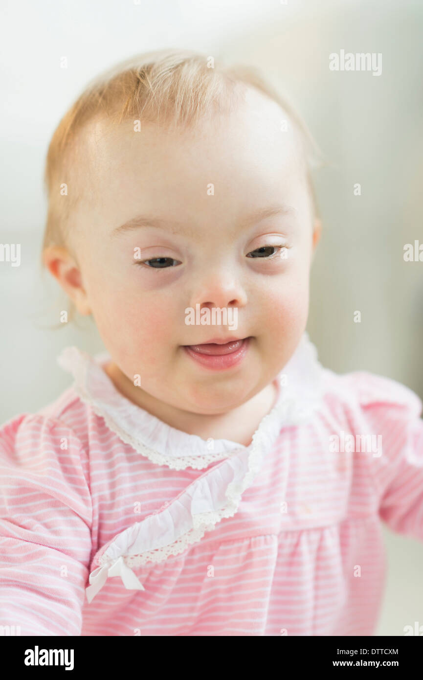 Baby girl down syndrome hi-res stock photography and images - Alamy Baby girl down syndrome hi-res stock photography and images - Alamy