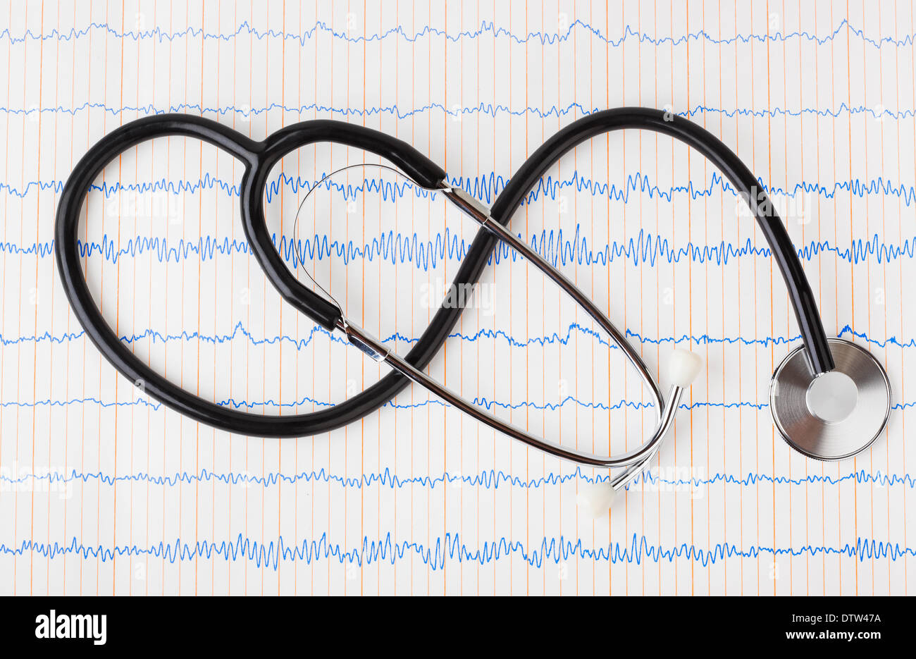Stethoscope on ecg Stock Photo - Alamy