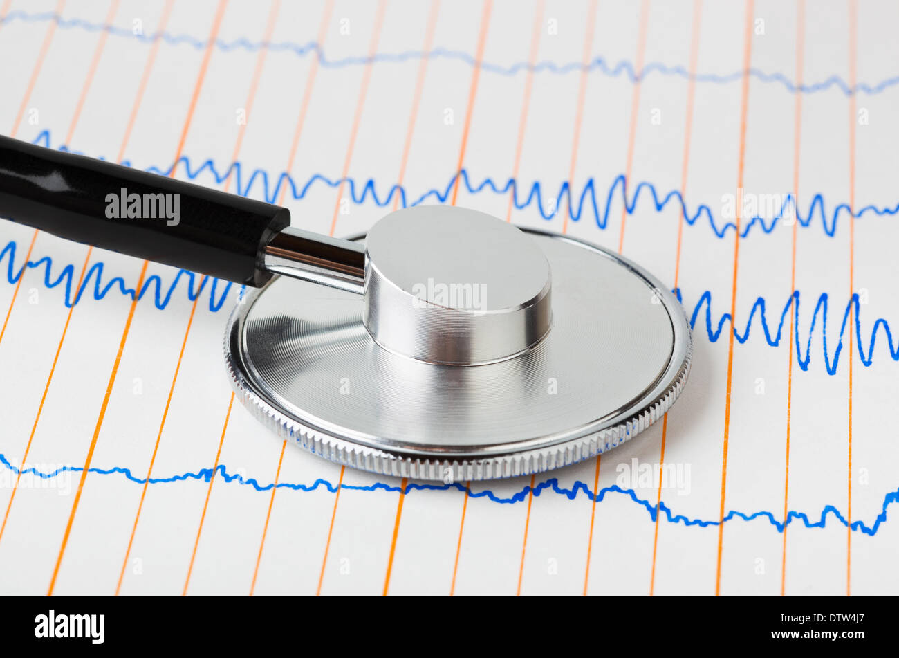 Stethoscope on ecg Stock Photo - Alamy