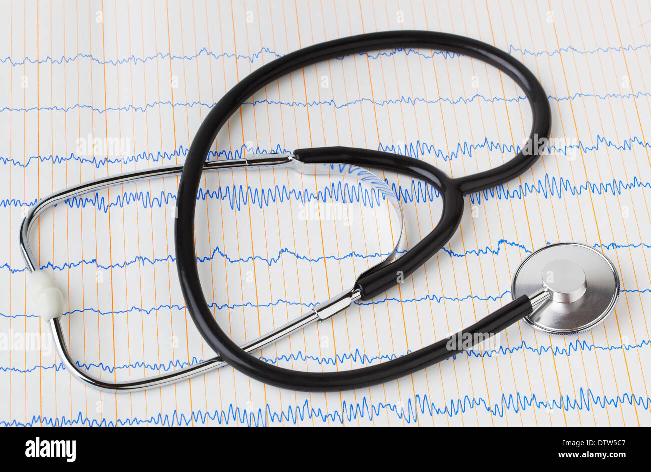 Stethoscope on ecg Stock Photo - Alamy