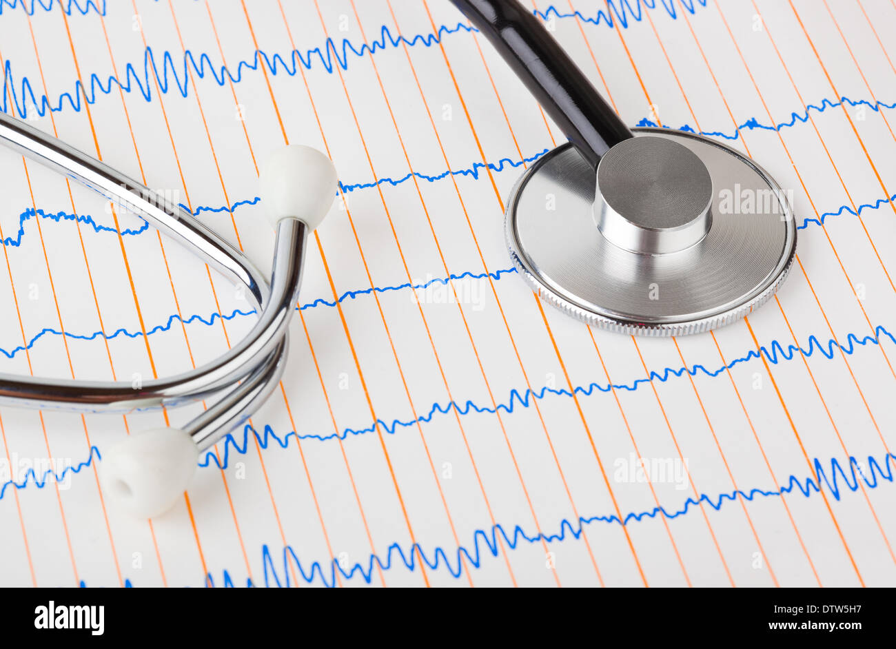 Stethoscope on ecg Stock Photo - Alamy