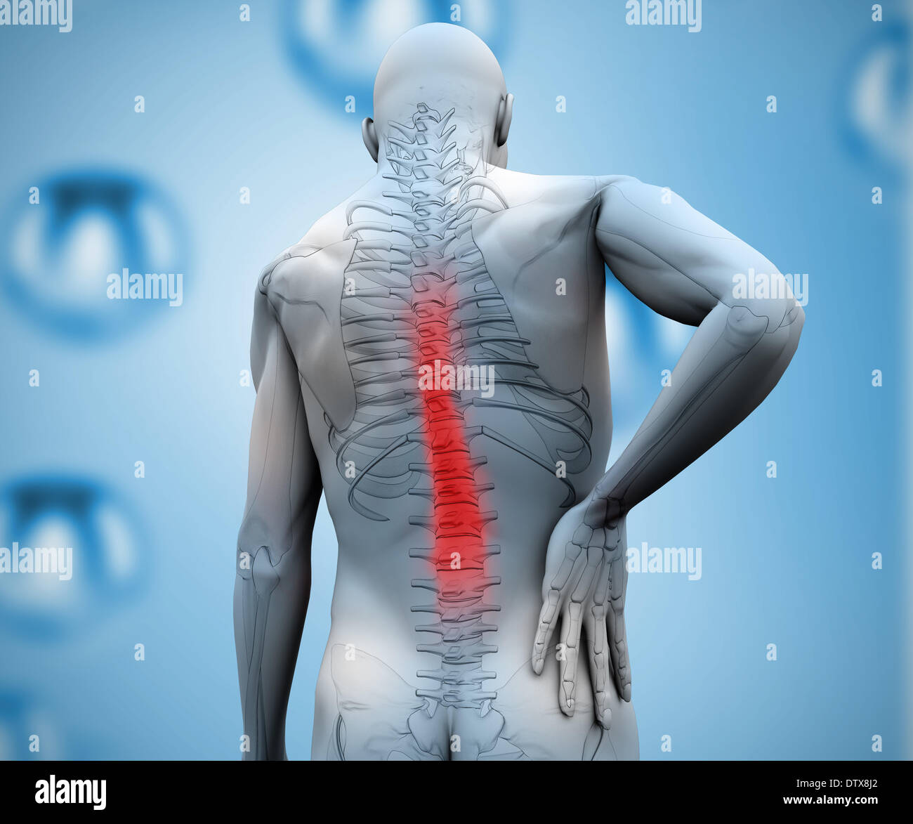 Digital figure with highlighted back pain Stock Photo - Alamy