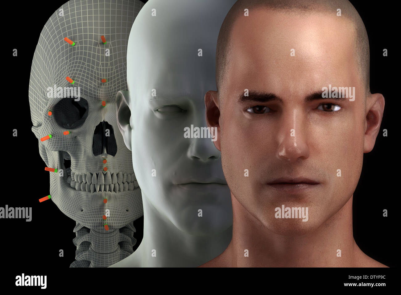 Facial reconstruction hi-res stock photography and images - Alamy