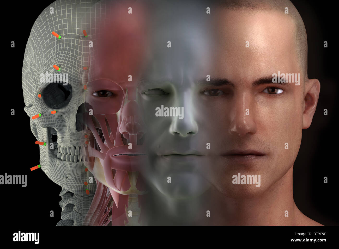 Facial reconstruction hi-res stock photography and images - Alamy