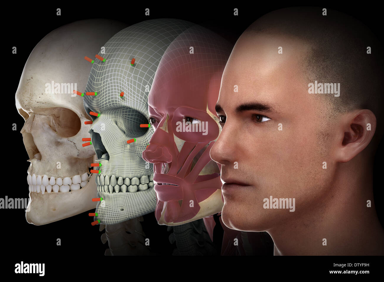 3d reconstruction of the skull hi-res stock photography and images - Alamy