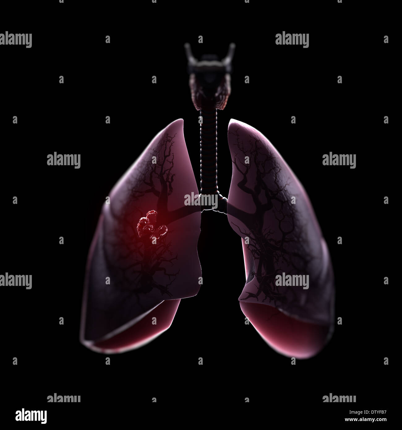 Respiratory system damage hi-res stock photography and images - Alamy
