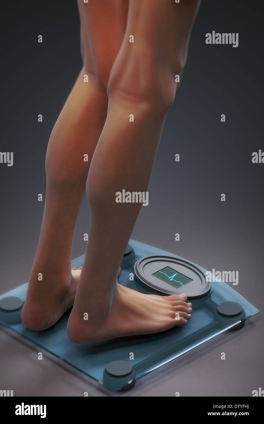 Anorexia nervosa woman illustration hi-res stock photography and images ...