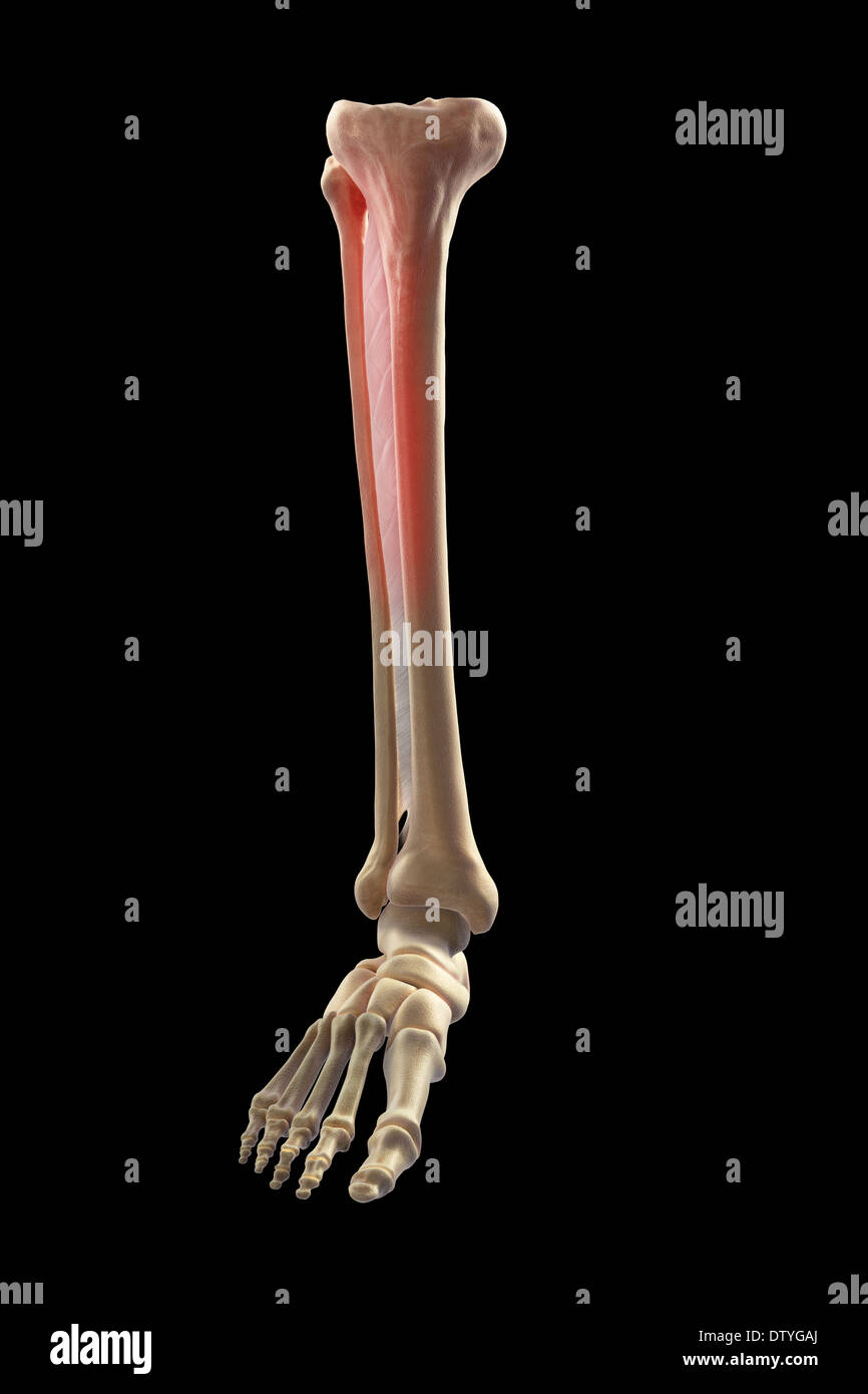 Medial Tibial Stress Syndrome Stock Photo - Alamy