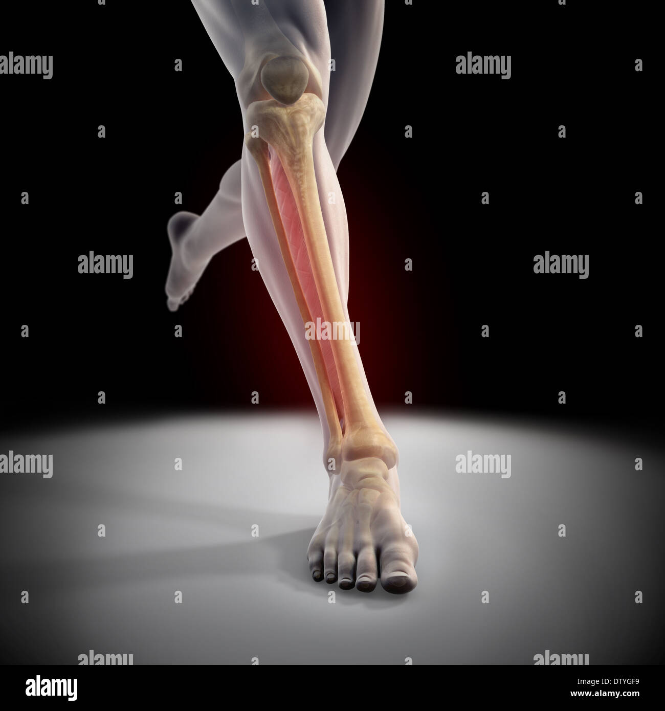 Medial Tibial Stress Syndrome Stock Photo - Alamy