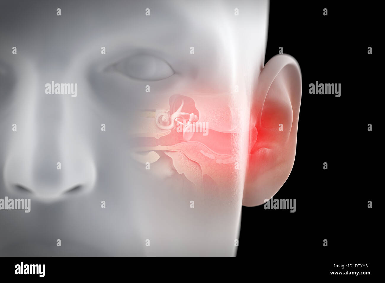 Ear damage hi-res stock photography and images - Alamy