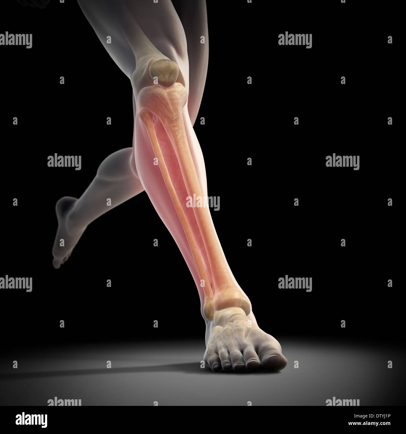 Medial Tibial Stress Syndrome Stock Photo - Alamy