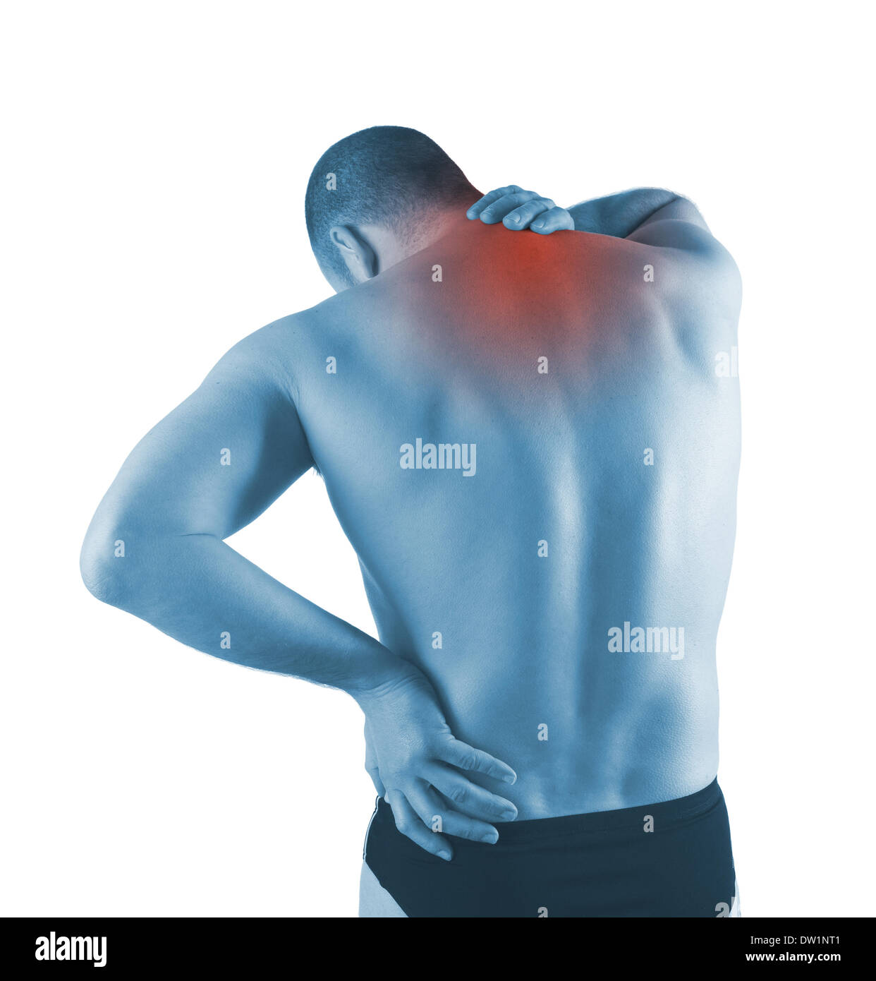 Muscular disease hi-res stock photography and images - Alamy