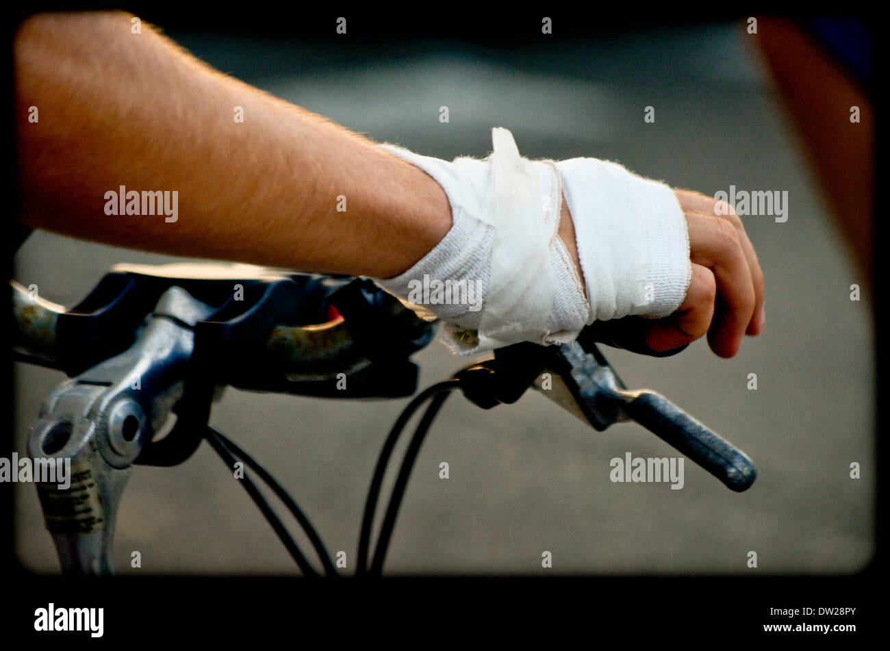 Bandaged up hand hi-res stock photography and images - Alamy