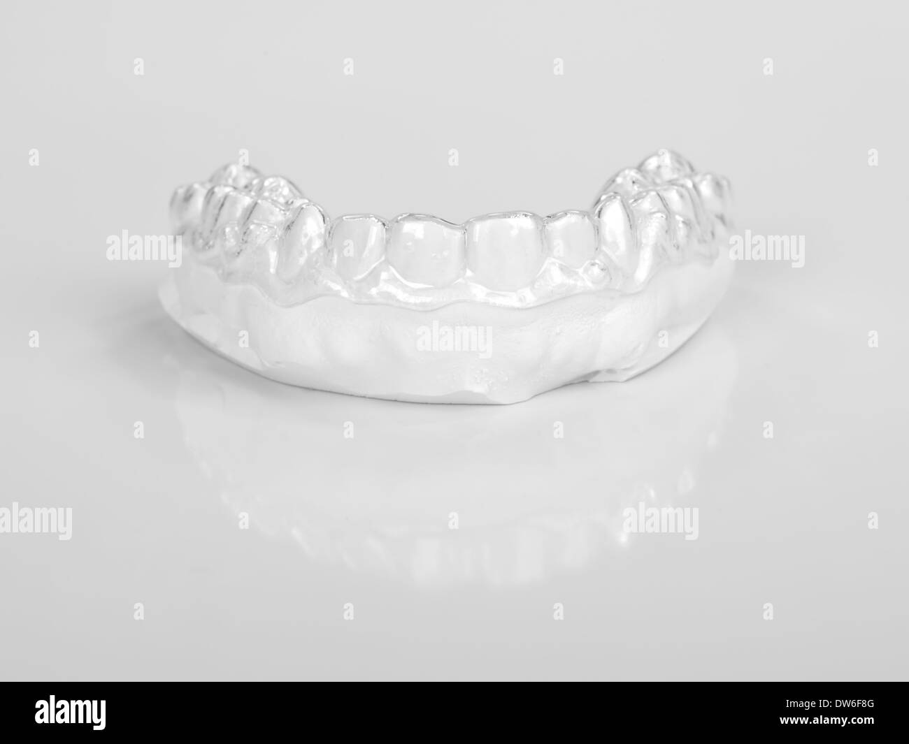 Translucent upper essix retainer on a plaster study model placed on a ...