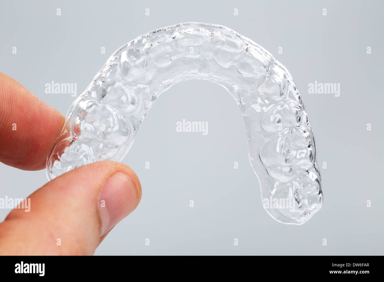 Translucent upper essix retainer on a plaster study model placed on a ...