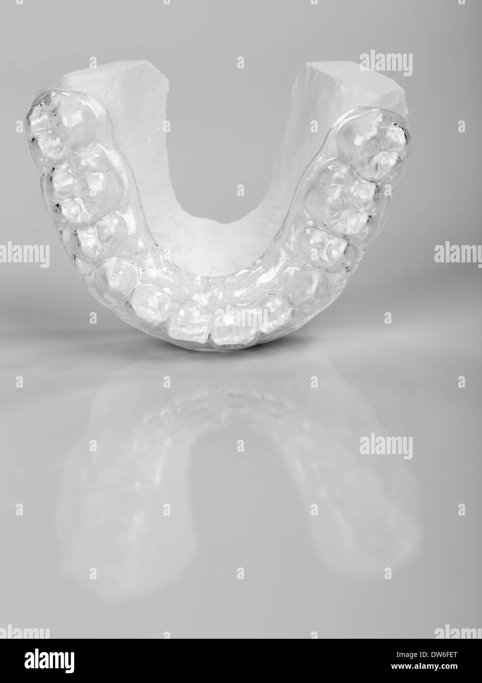 Translucent upper essix retainer on a plaster study model placed on a ...
