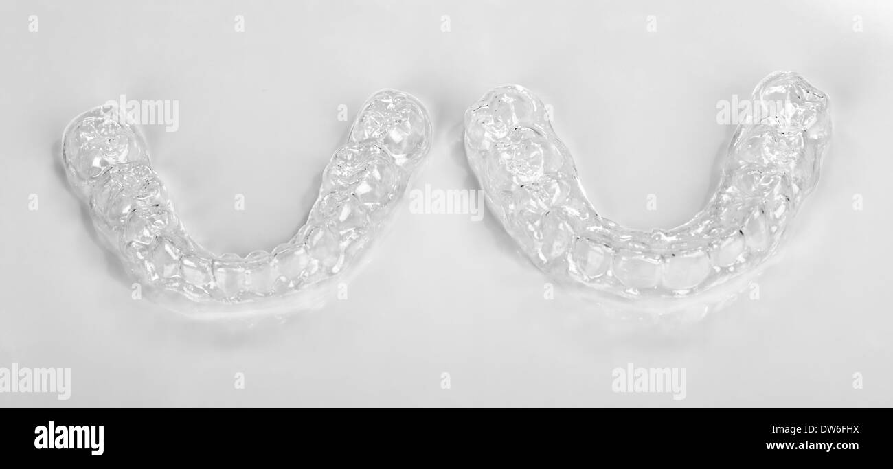 Translucent upper essix retainer on a plaster study model placed on a ...