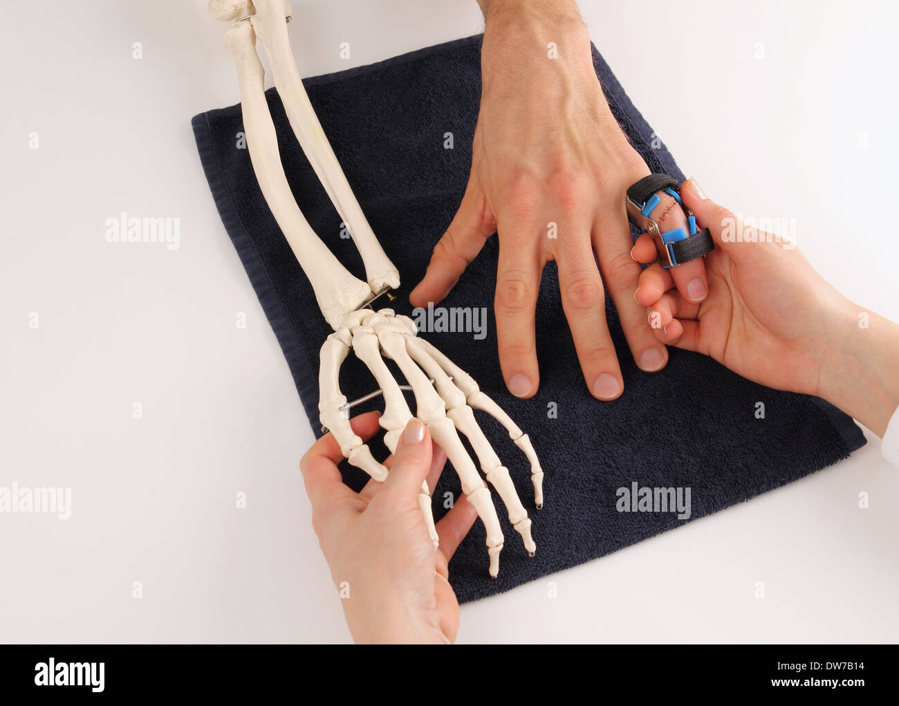 Hand surgeon with skeleton hand at patient Stock Photo - Alamy