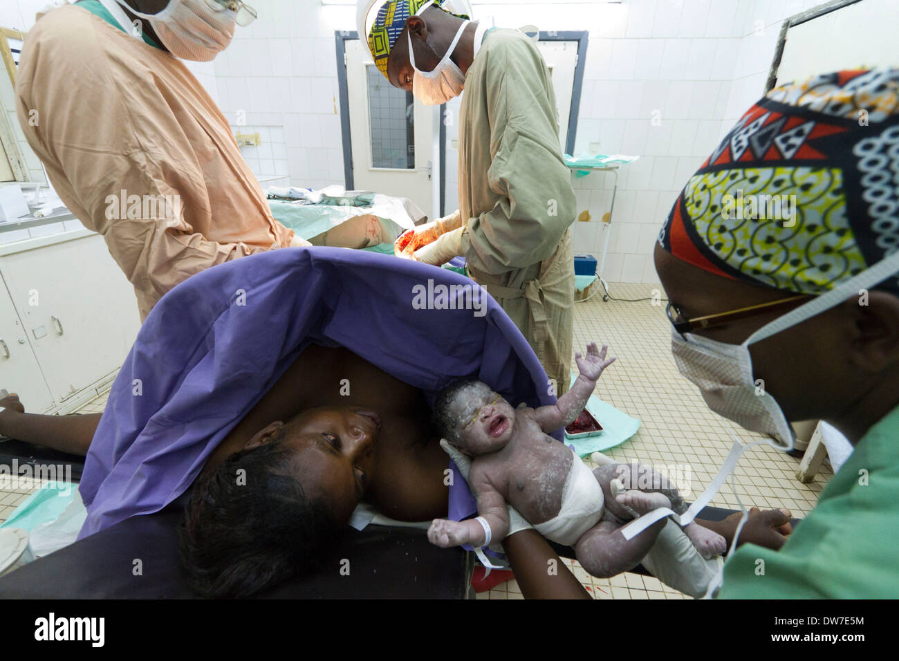 C-section in the MSF hospital ,Rutshuru,North Kiwu ,DRC,Democratic ...