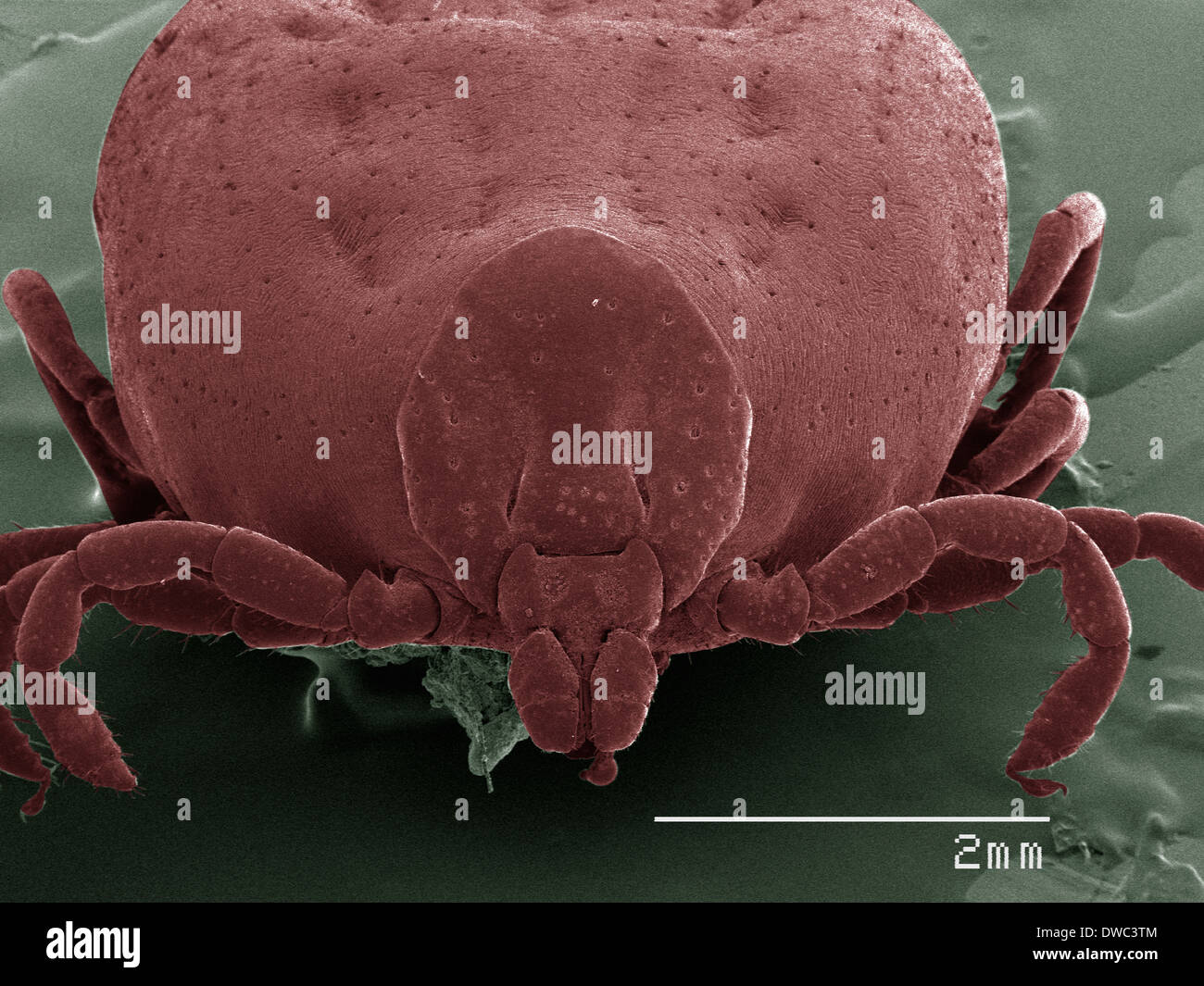 Coloured SEM of tick, front view Stock Photo - Alamy