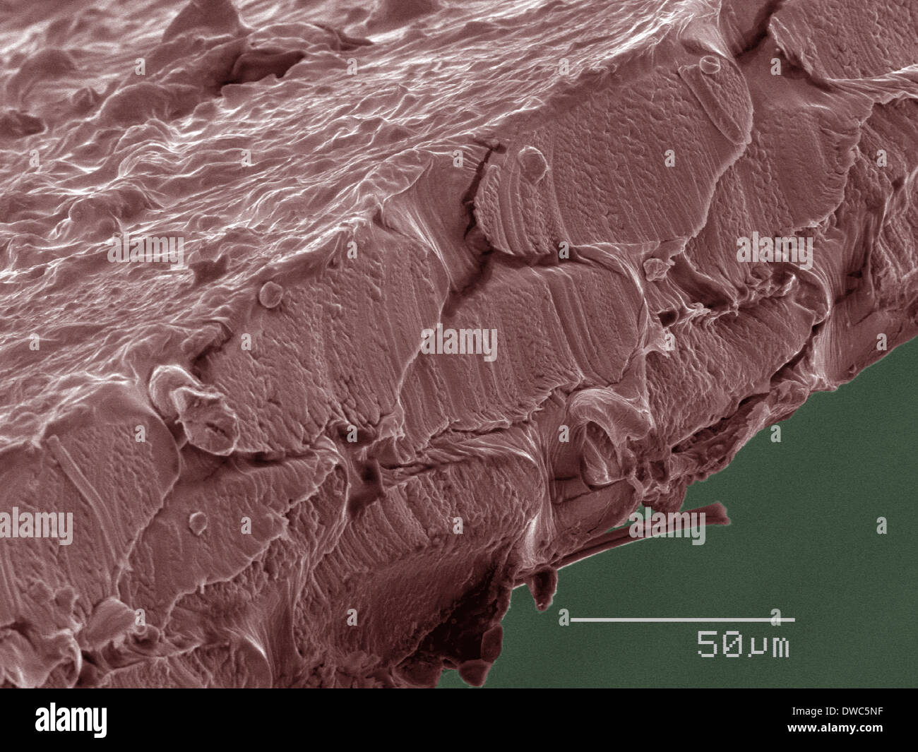 Coloured SEM of dental floss Stock Photo - Alamy