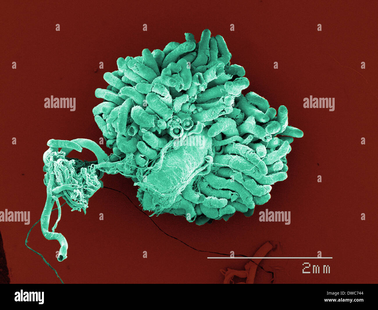 Coloured SEM of American cockroach gut and malpighian tubules Stock ...