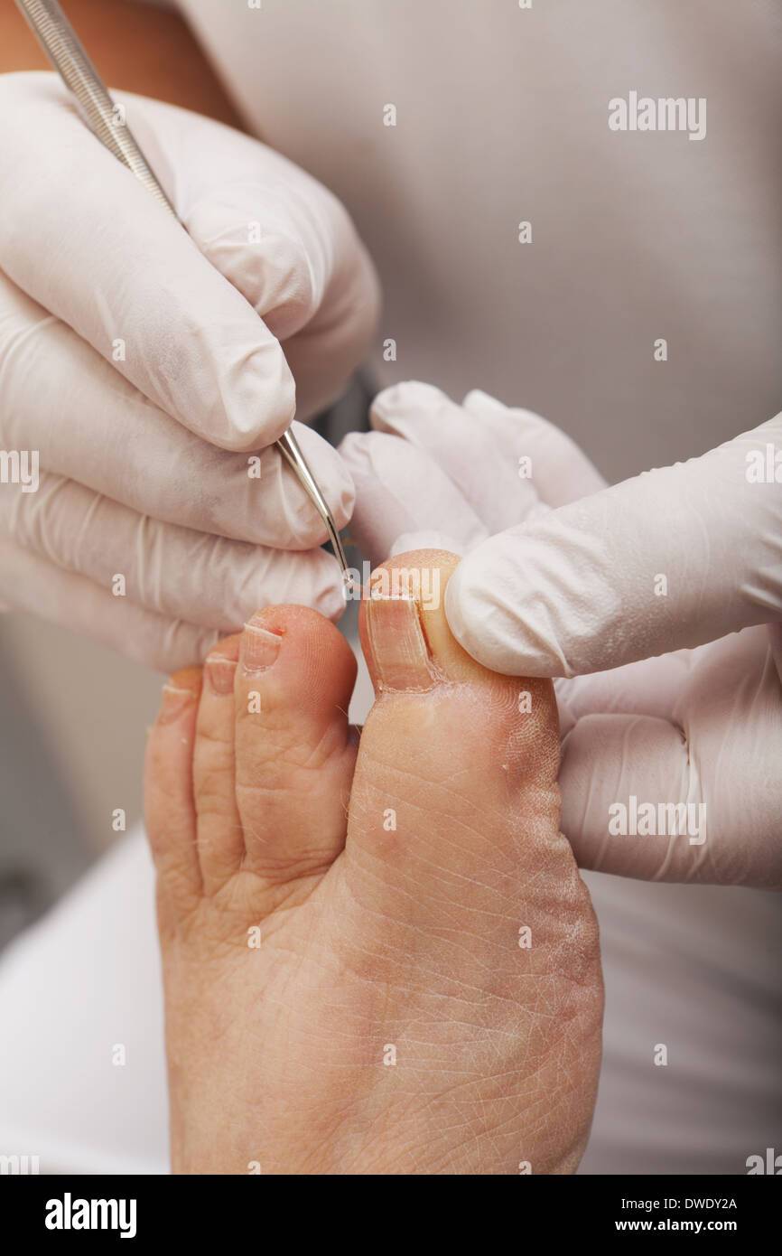 Chiropodist High Resolution Stock Photography and Images - Alamy