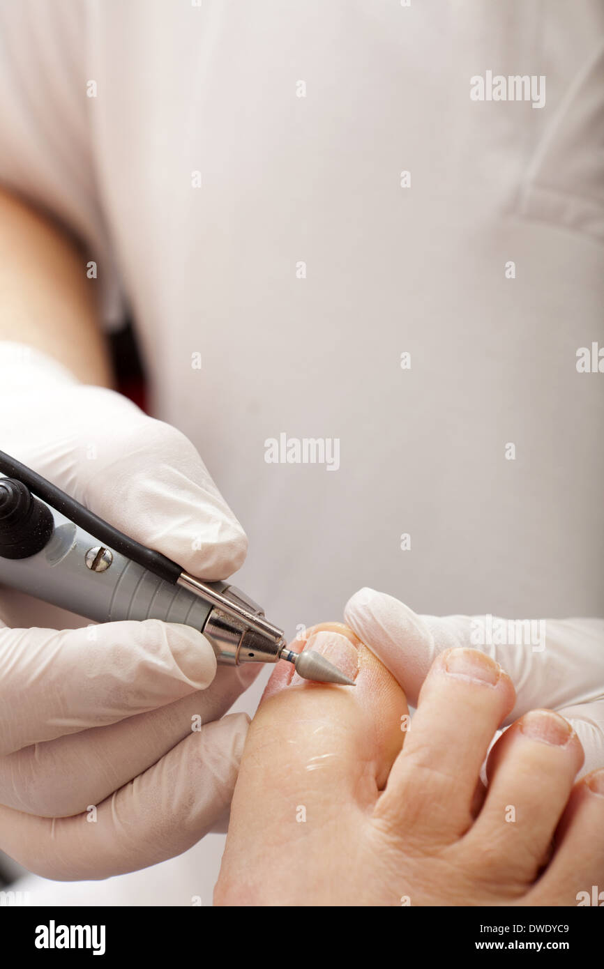 Medical Foot Care London at Jerome Henderson blog