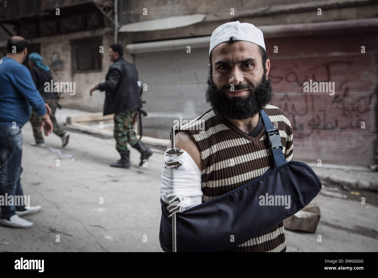 Injured fighter hi-res stock photography and images - Alamy