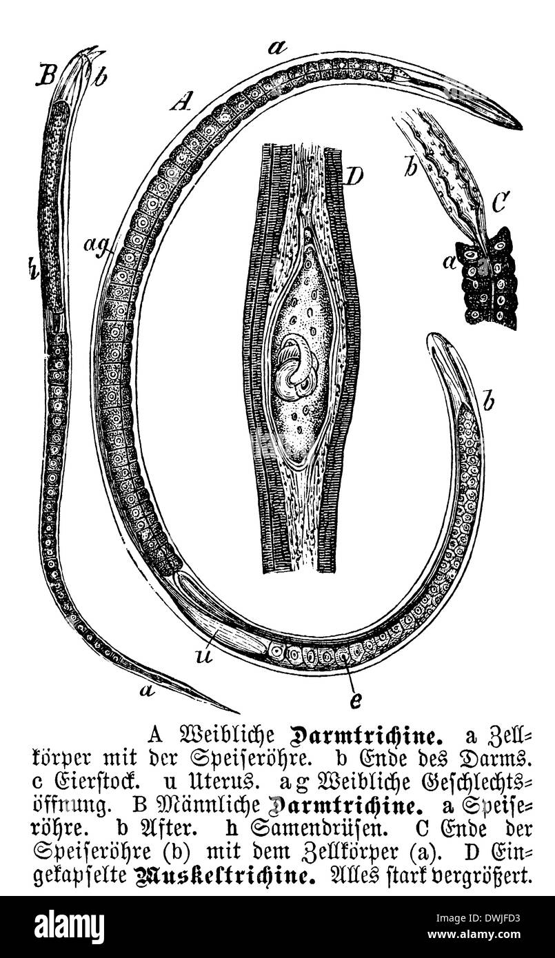 Trichina hi-res stock photography and images - Alamy